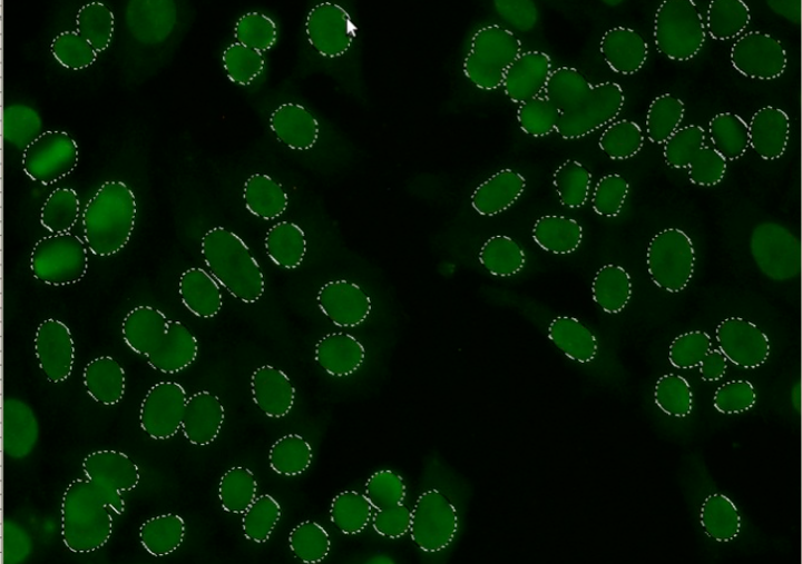 ICPR-HEp-2 细胞分类数据集介绍 - 知乎
