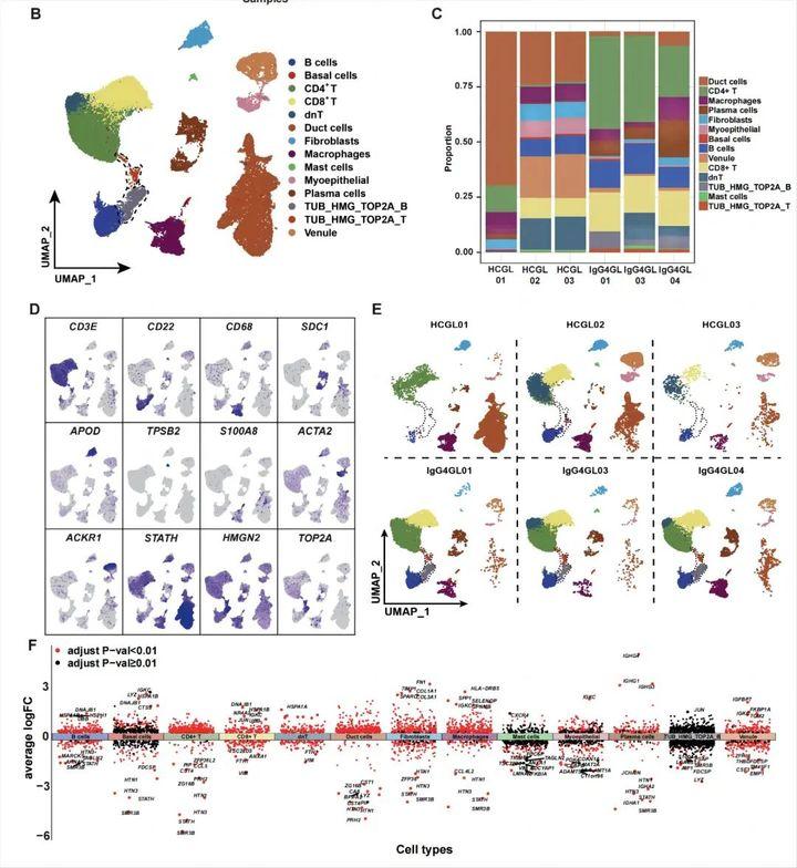 IgG4相关性疾病中颌下腺和血液中的细胞和分子改变 - 知乎