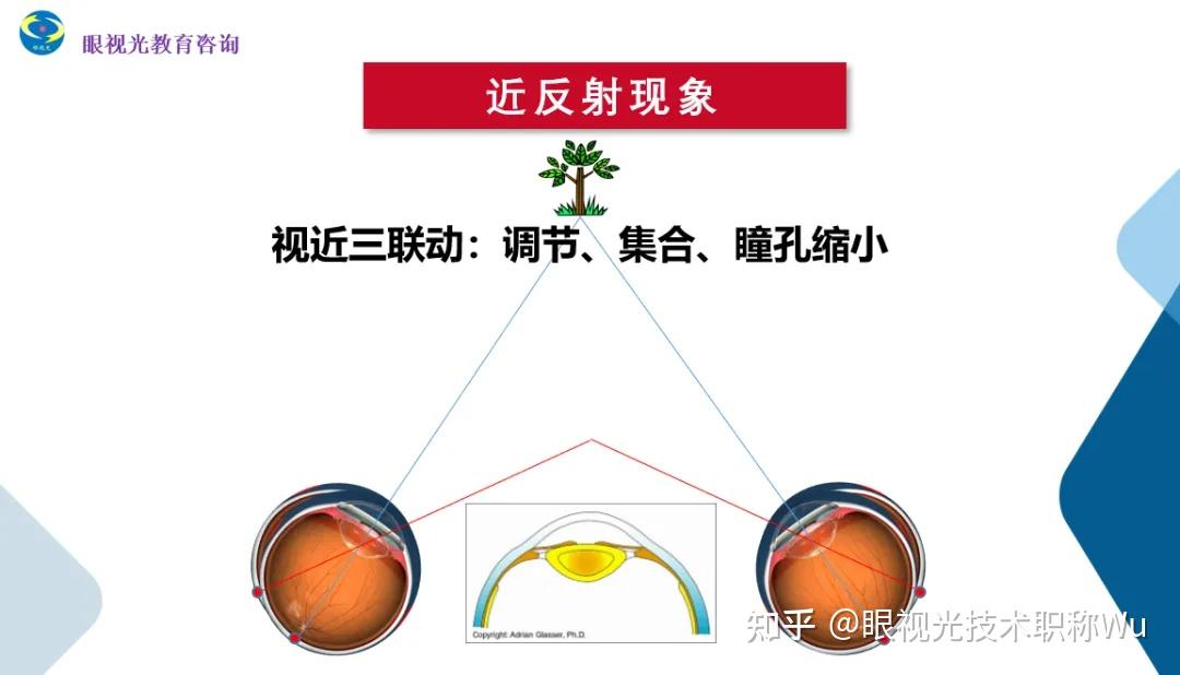 正负相对调节(NRA/PRA)大小的意义-eye收藏系列24 - 知乎
