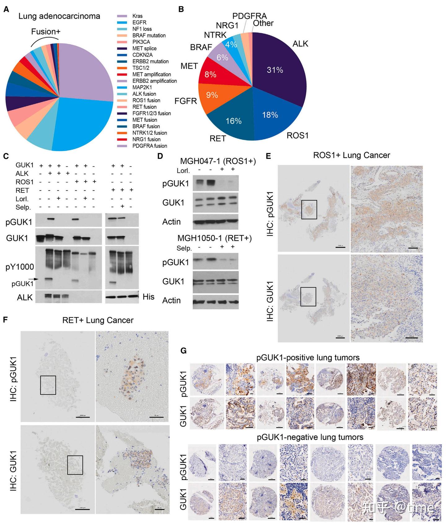 文献分享 | Cell：GUK1激活是肺癌的代谢倾向 - 知乎