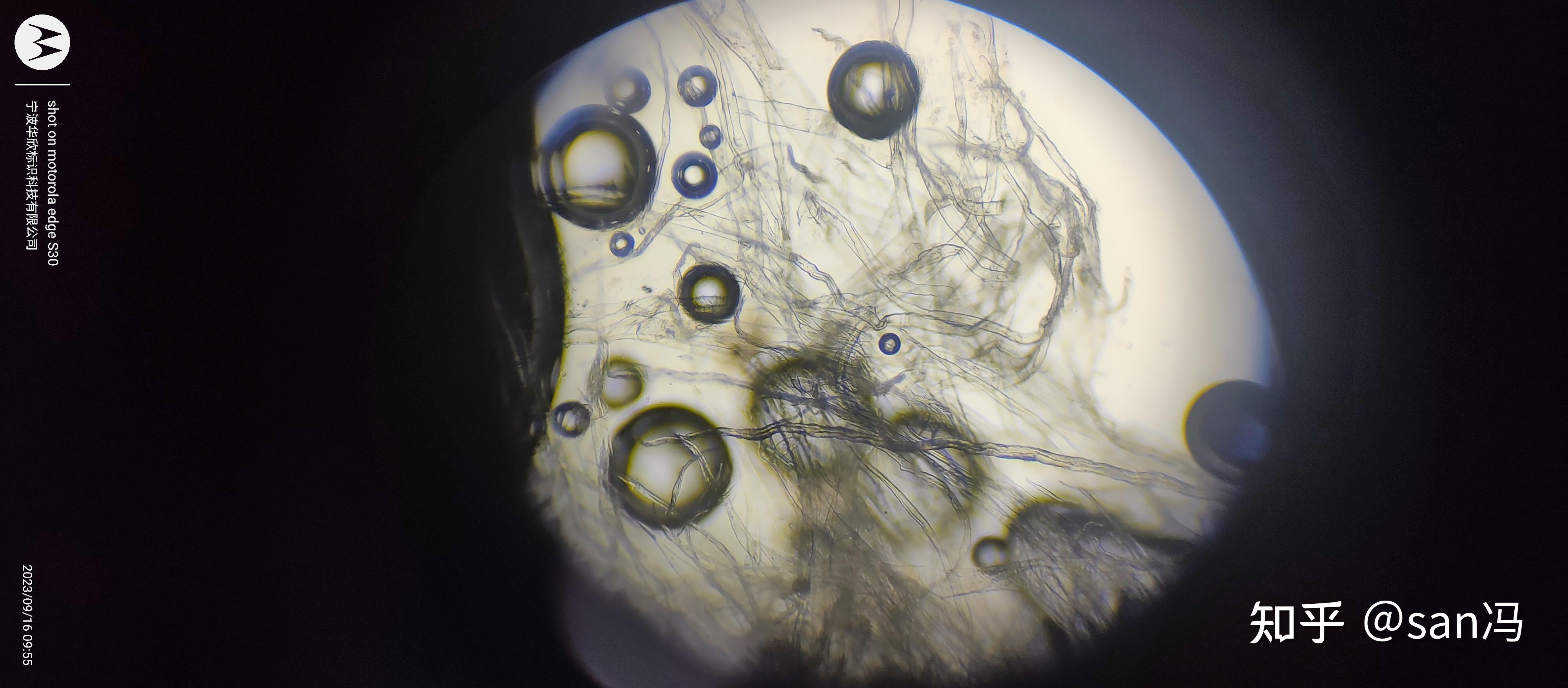 如何区分显微镜下的真菌？ - 知乎