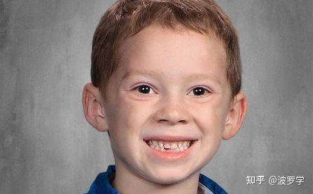 Go 中 struct tag 如何用？基于它实现字段级别的访问控制 - 知乎