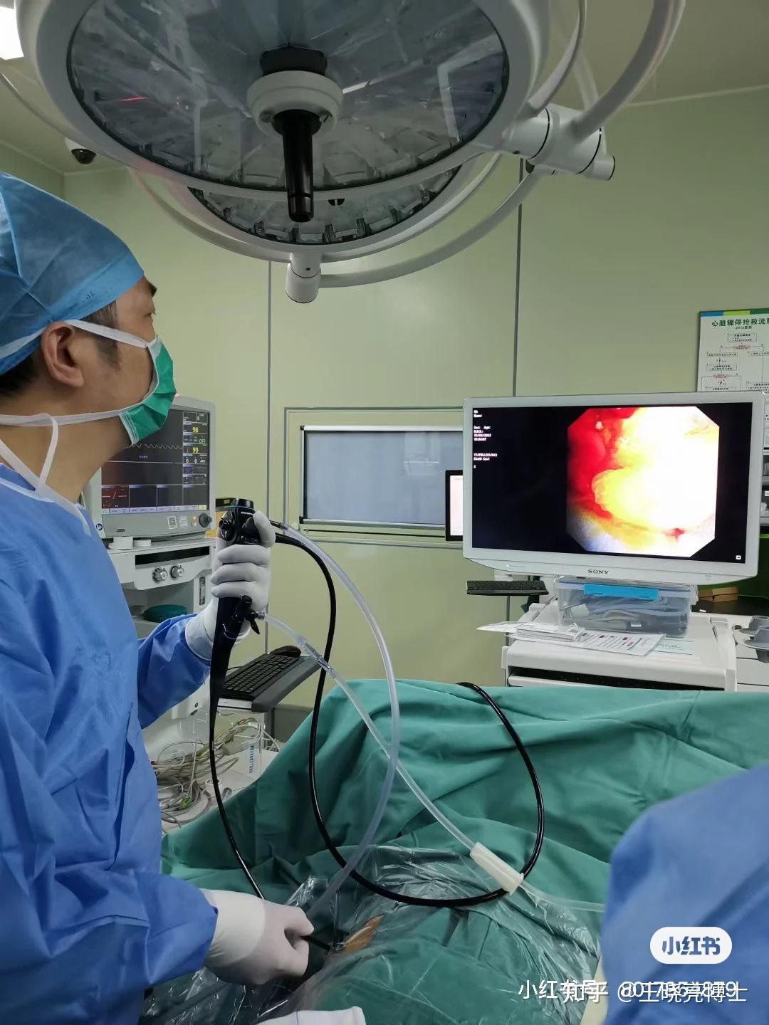 手术分享｜高难度PTCD置管减黄 - 知乎