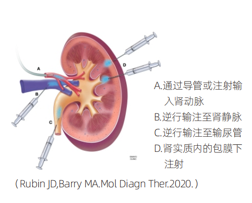 肾脏研究中常用的AAV注射方式有哪几种？ - 知乎