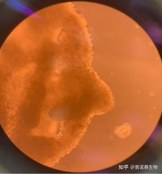 细胞学堂 | 脱落的293T细胞如何恢复正常 - 知乎