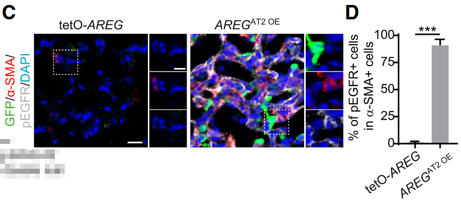 240919 文献精读Plus Cell Stem Cell AREG+肺纤维化 - 知乎