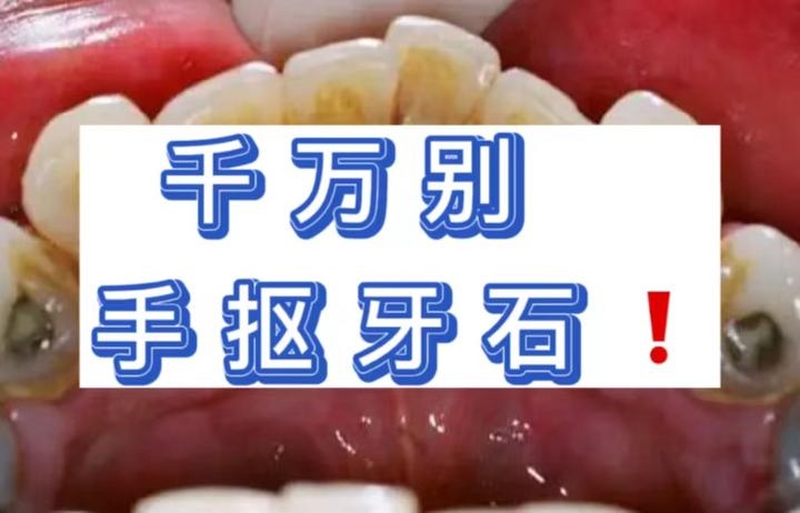 千万别用手抠牙结石!每天这样刷牙3分钟,成片牙石唰唰掉!! 知乎