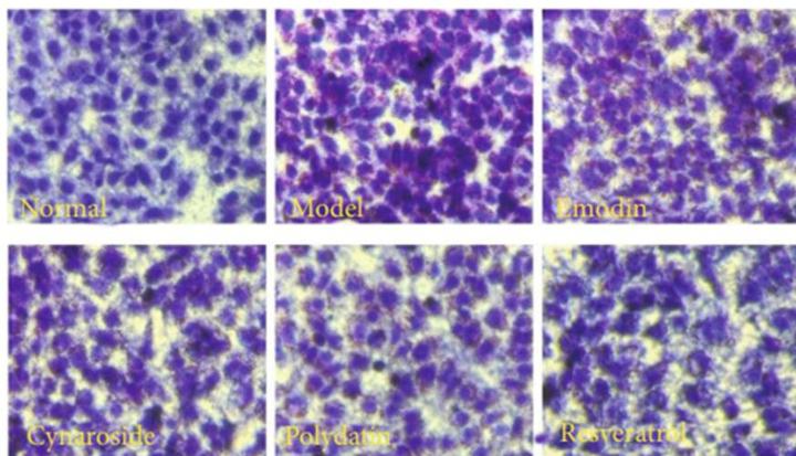 使用油酸钠添加剂诱导HepG2脂肪肝细胞模型经验分享与交流 - 知乎