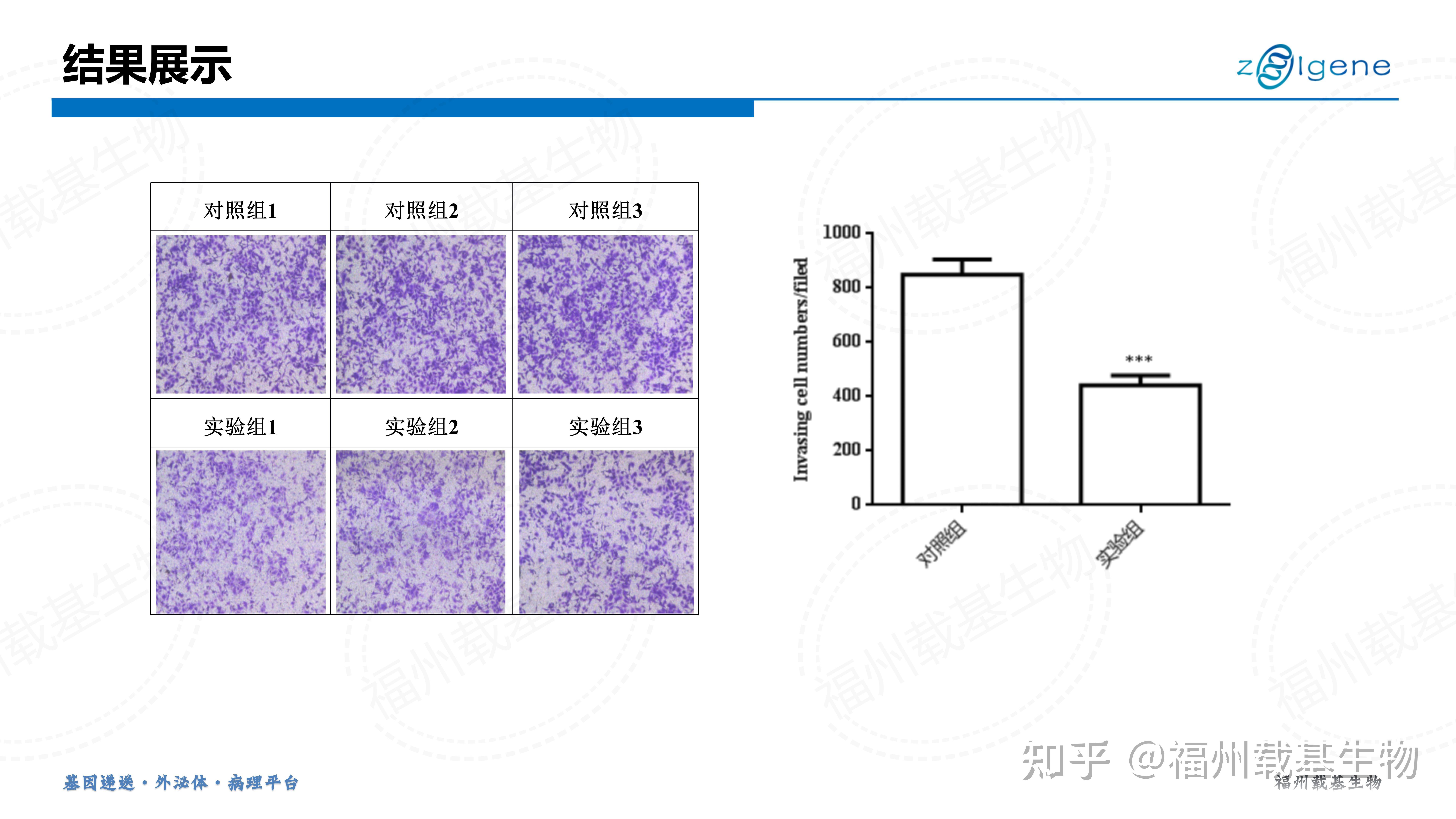 transwell侵袭实验? - 知乎