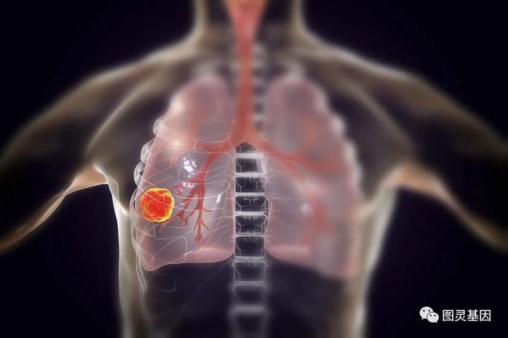 Nat Immu | 巨噬细胞抑制肺癌中NK细胞的募集和激活 - 知乎