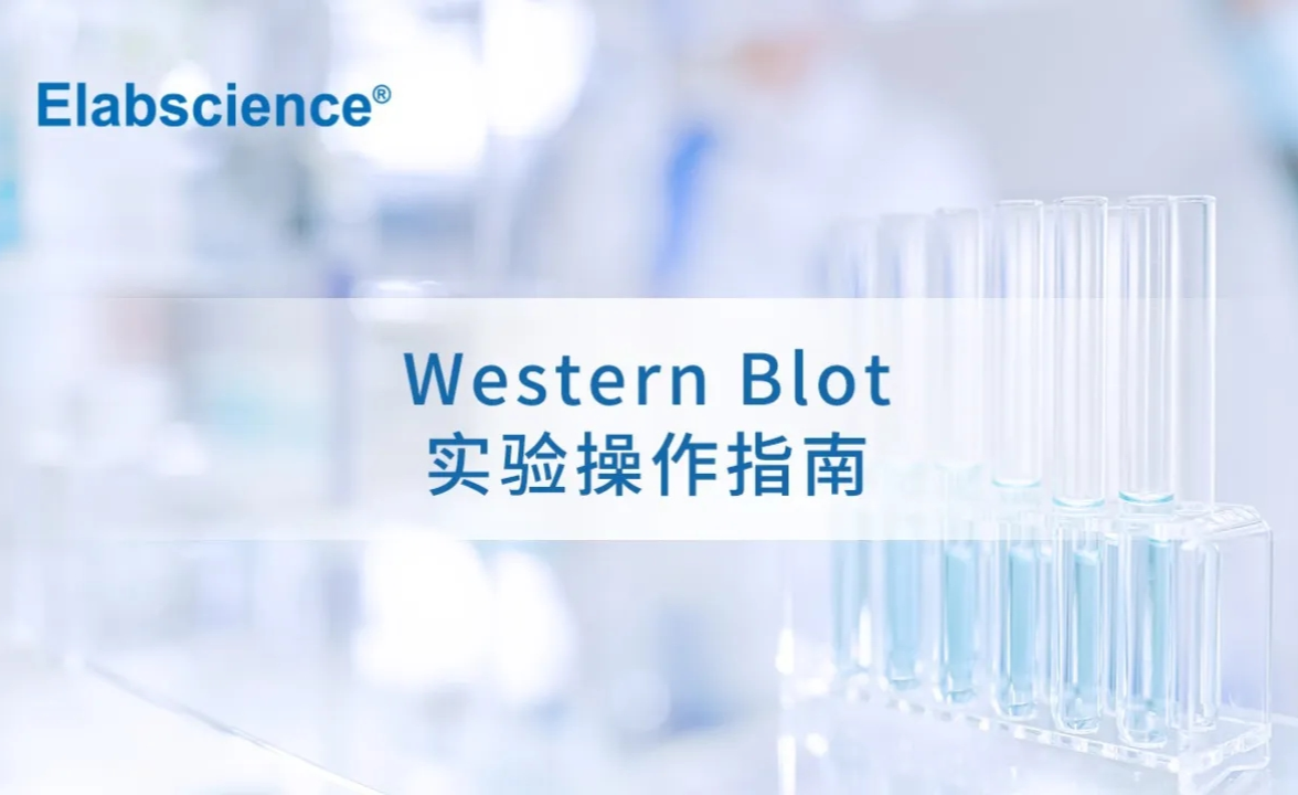 检测实验样本中的靶蛋白，ELISA、WB、IHC选哪个？ - 知乎