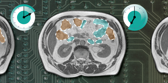 UW-Madison GI Tract Image Segmentation 肠胃部磁共振分割数据集介绍 - 知乎