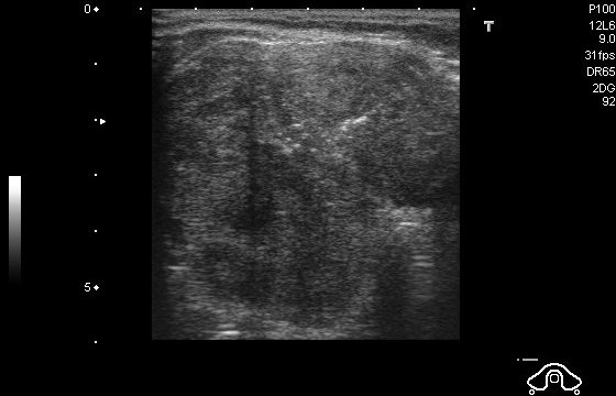 DDTI 数据集介绍 - 知乎