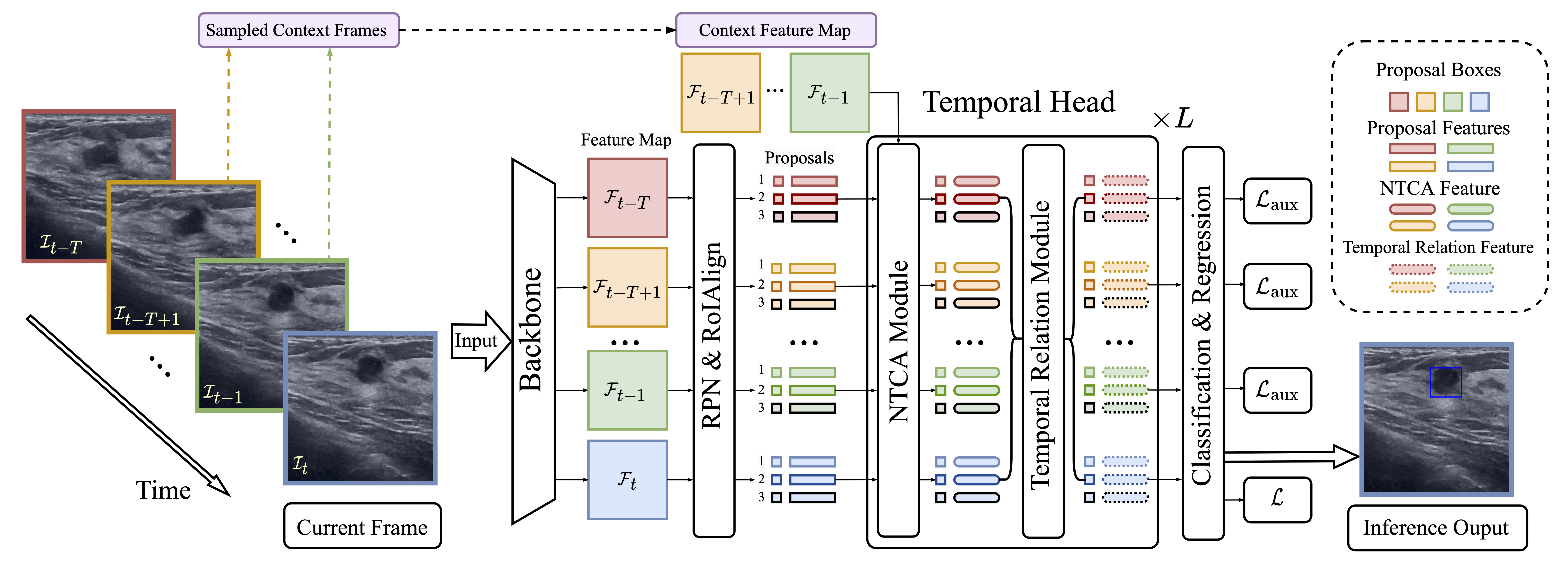 MICCAI23 | UltraDet: 使用时序上下文抑制在超声视频检测中的假阳性（代码+数据标注已开源） - 知乎