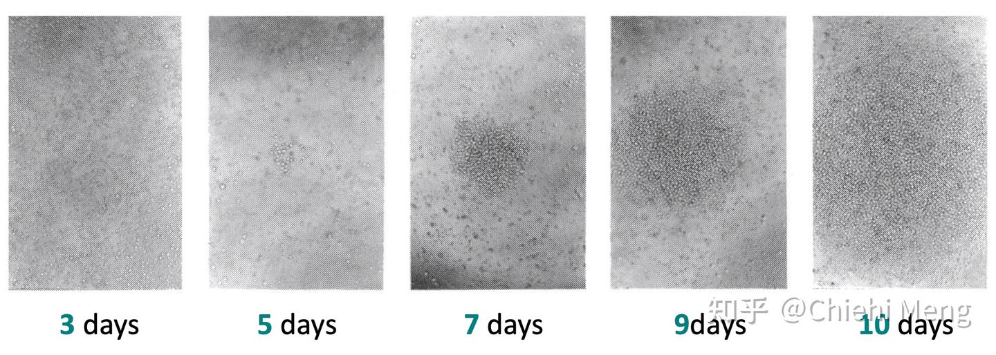 手把手教你制作单克隆抗体（实验室制备抗体） - 知乎