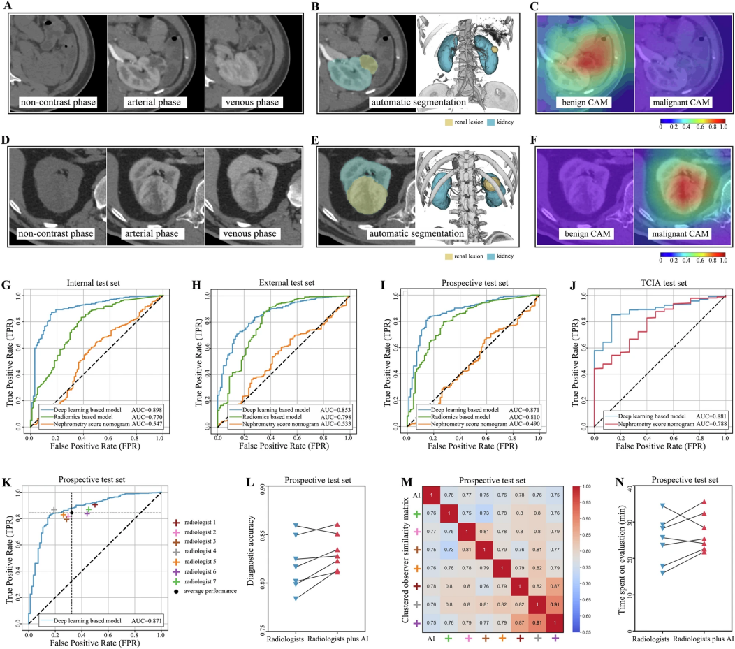 Nat. Commun. | AI助力精准诊断：分析患者多阶段CT扫描让肾脏肿瘤无所遁形 - 知乎