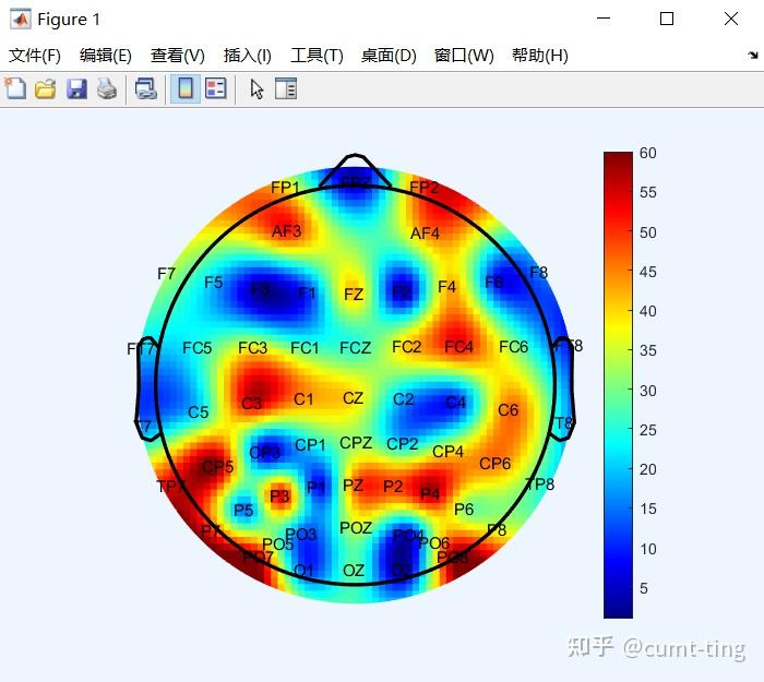 Matlab绘制EEG脑电头皮地形图 - 知乎