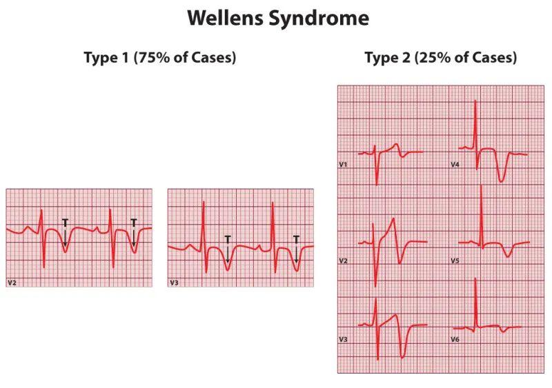 心电图的空间密码：从电向量到动态对比的临床解码 - 知乎