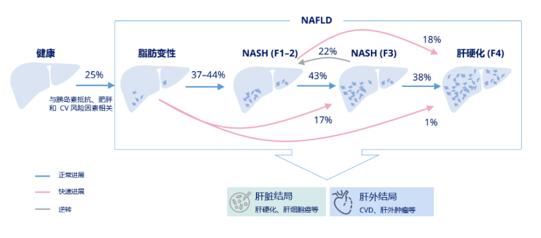 盘点 | NAFLD/NASH全球在研药物进展 - 知乎