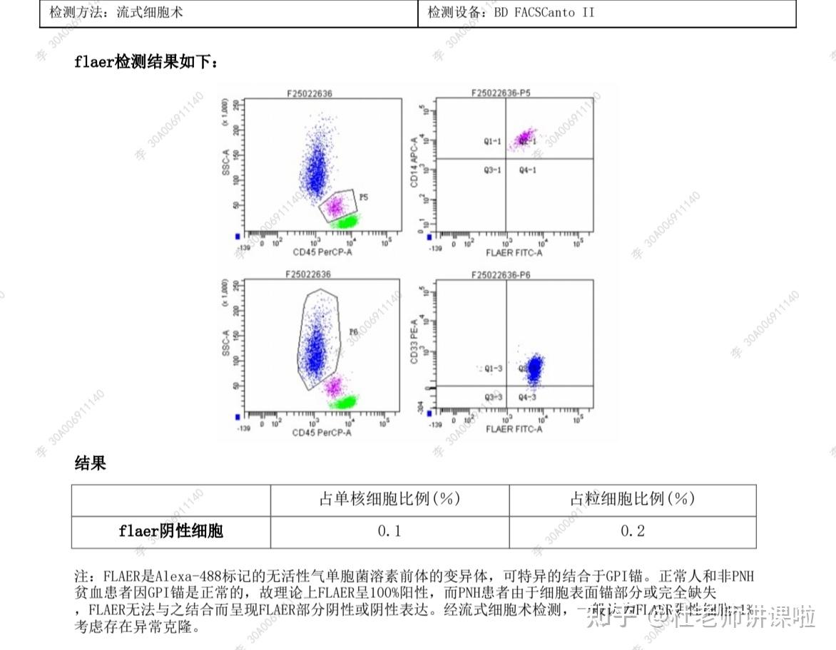 如何判读PNH疾病中FLAER检测的结果？ - 知乎