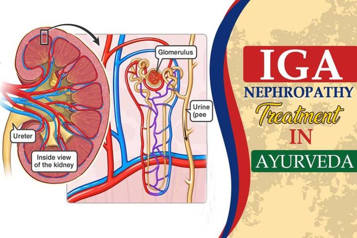 IgA肾病：肾功能衰退的评估与分析（上） - 知乎