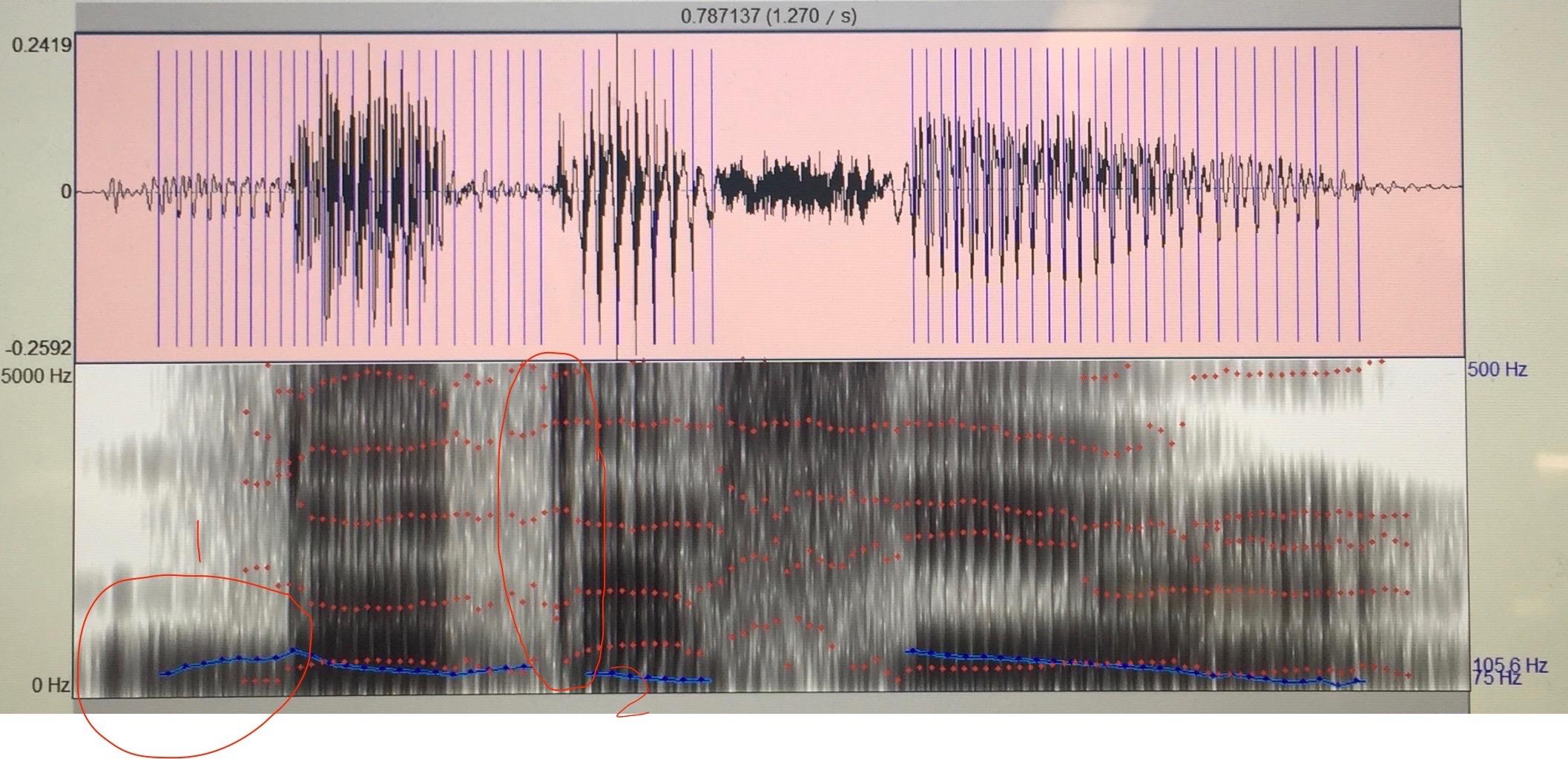关于 Praat 的 spectrogram 怎么来区分辅音？ - 知乎