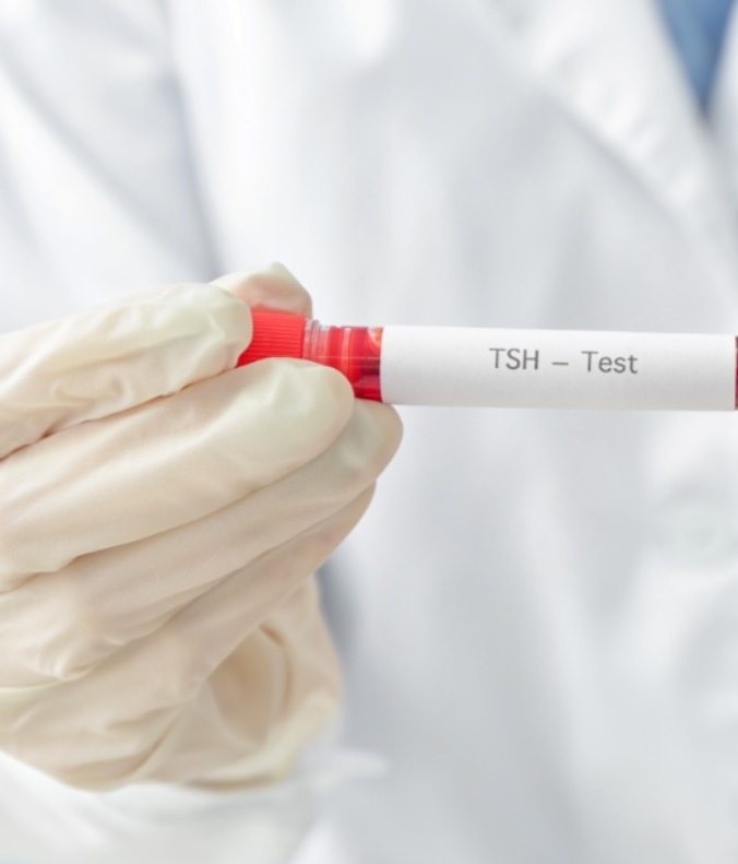 极致灵敏、稳定如一，超高敏TSH配对原料助你在甲功检测赛道脱颖而出！ - 知乎