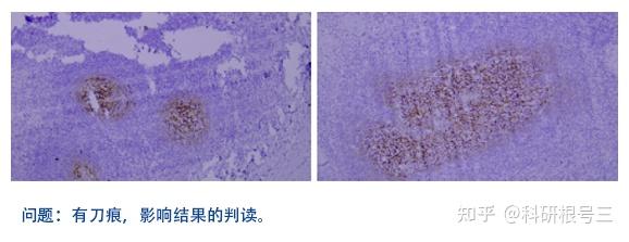 怎么分析免疫组化结果？ - 知乎