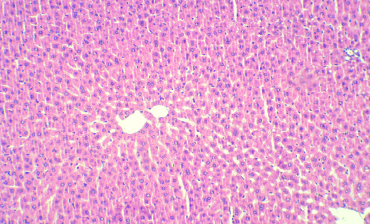干货：部分染色的病理分析技巧分享 - 知乎