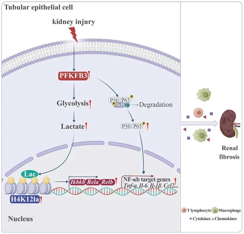 Kidney Int | 中山一院揭示PFKFB3通过组蛋白乳酸化驱动肾纤维化 - 知乎