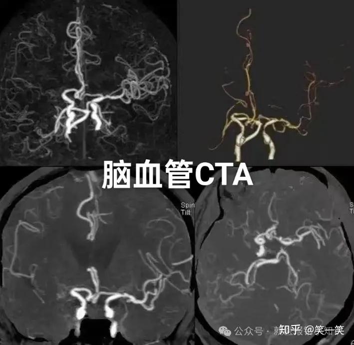 什么是DSA?与CTA有何区别？ - 知乎
