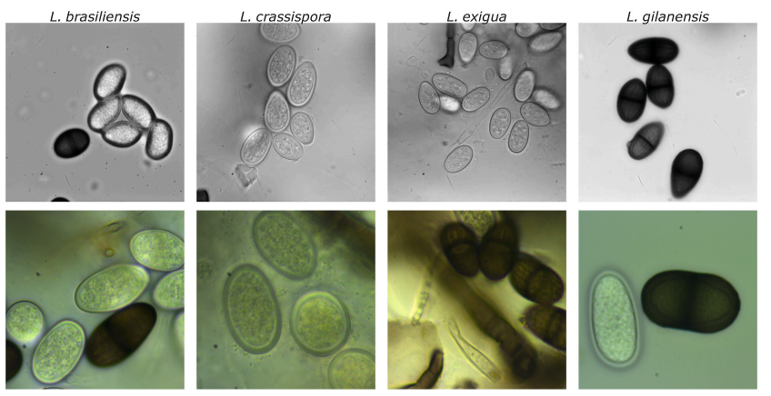 利用深度学习开发葡萄真菌孢子分类的显微镜图像数据集 - 知乎