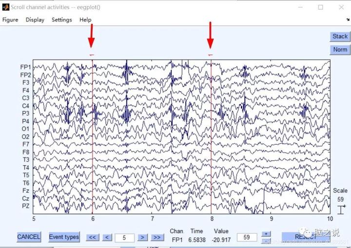 如何利用EEGlab工具包在EEG数据中手动插入Marker？ - 知乎
