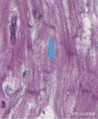 HE染色特征：易混淆组织对比 - 知乎