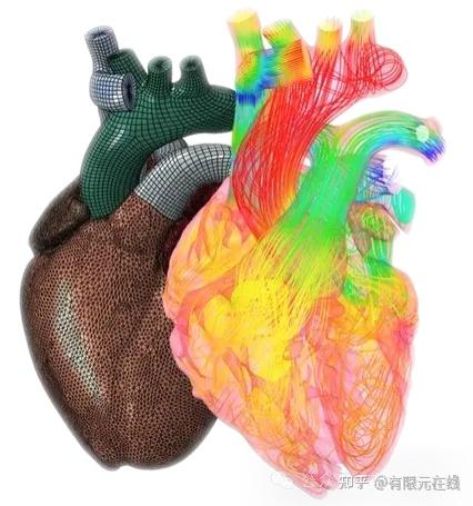FlowVision在心脑血管生物力学CFD仿真分析的应用 - 知乎