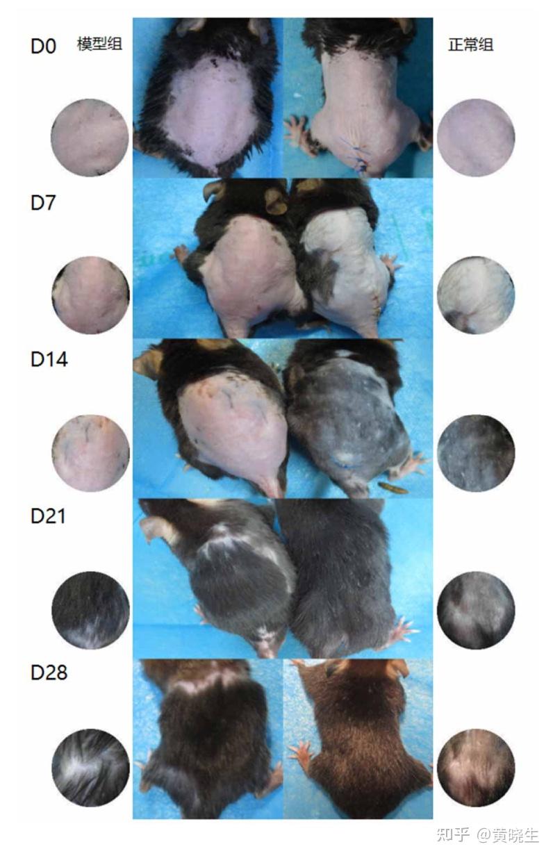 雄激素脱发小鼠（AGA）模型 - 知乎