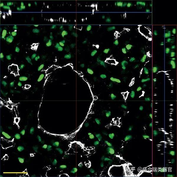 STAR Protoc.：hPSC胰腺类器官培养方法——早期胰腺研究新工具 - 知乎