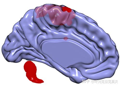 科学可视化软件介绍 – 人类大脑解剖图可视化软件Surf Ice - 知乎