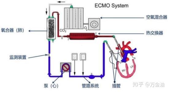 新冠肺炎疫情关键时刻能救命的ECMO，为何全国只有400台且治疗费用这么高？ - 知乎