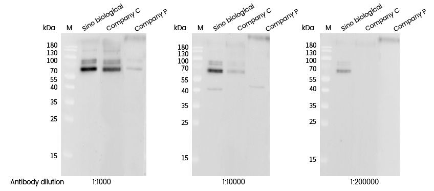 体型控制器：S6K1 - 知乎