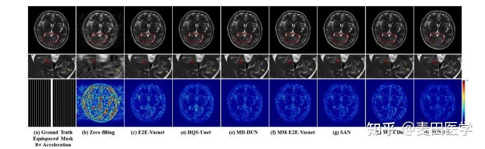 用于多模态MRI重建的具有空间对齐的深度展开网络|文献速递--基于多模态-半监督深度学习的病理学诊断与病灶分割 - 知乎