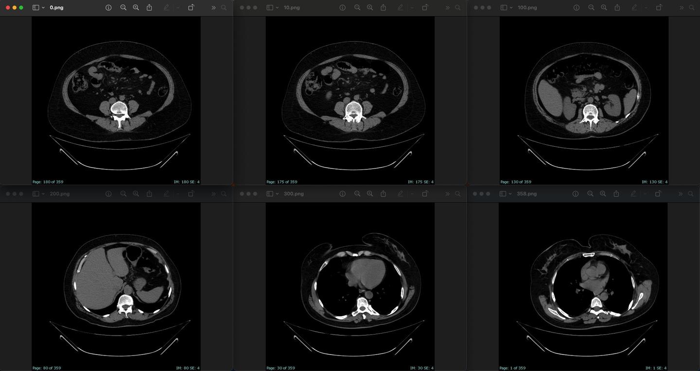 M3D-Cap 数据集介绍 - 知乎