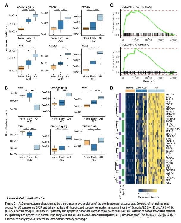 Gut（IF=23.1）|| 纵向配对肝活检和转录组分析揭示酒精相关性肝炎中细胞衰老的动态变化 - 知乎