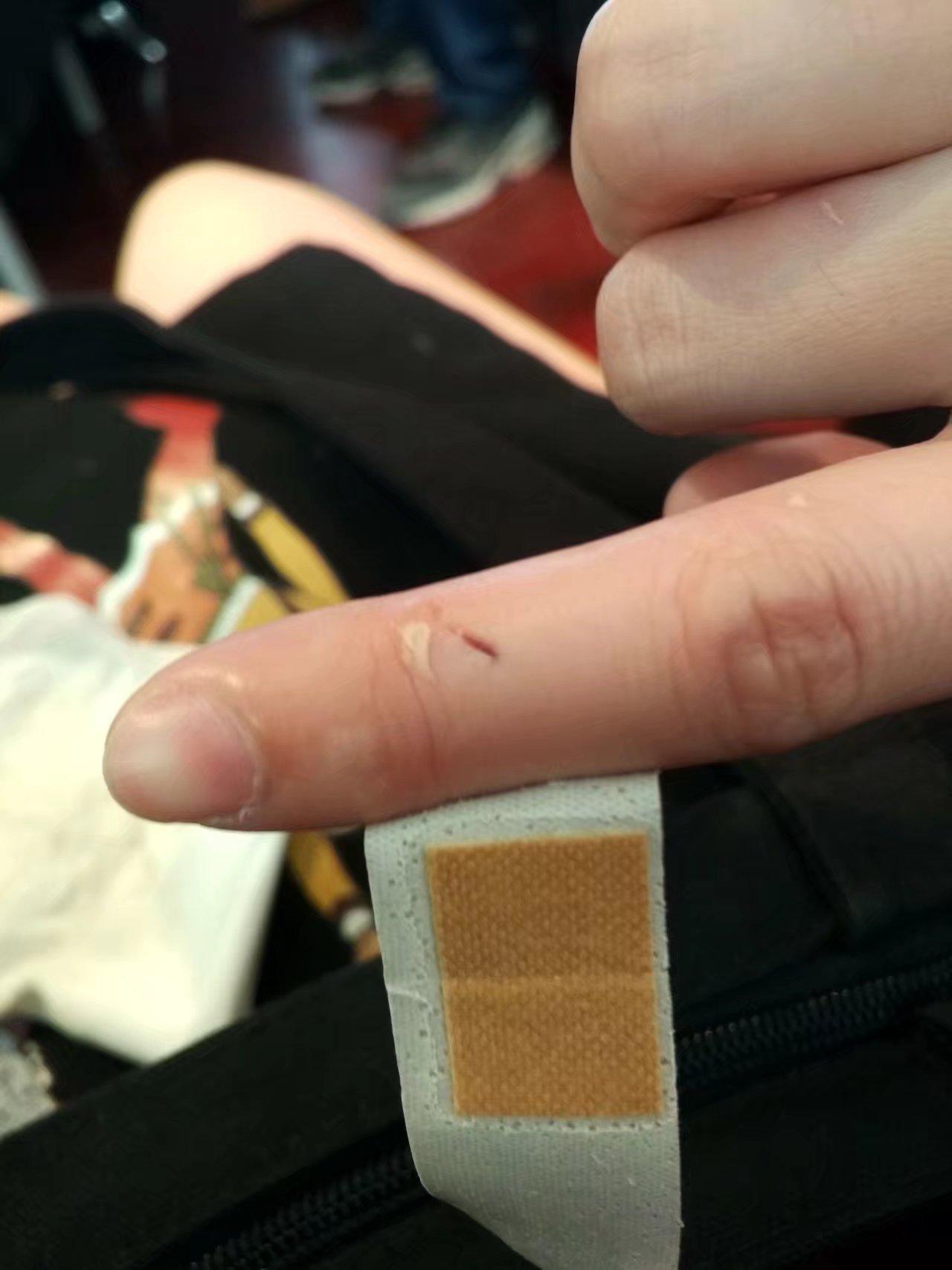 手指关节被门夹了一下是什么感受？ - 知乎