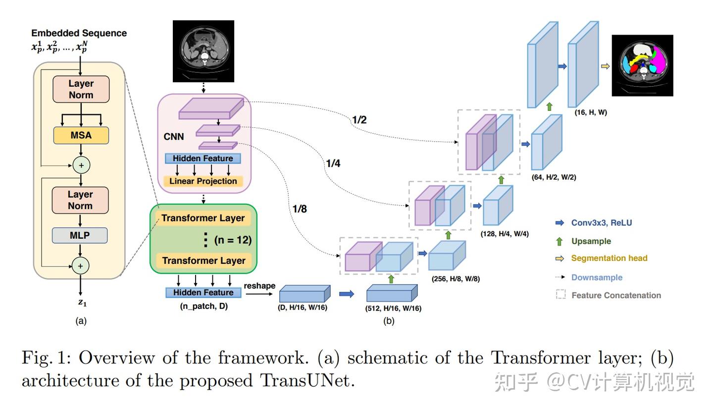 基于Transformer的医学图像分割15篇论文及开源代码 - 知乎