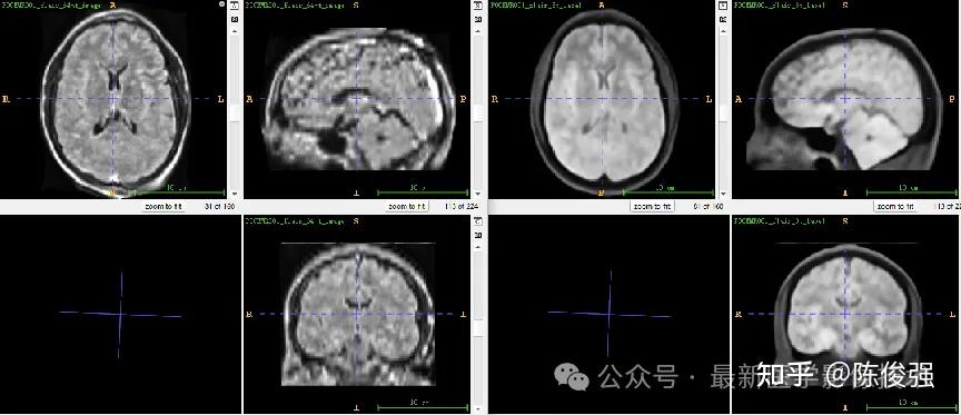 ULF-EnC2025——配对超低场 MRI 增强生成到高场 MRI - 知乎