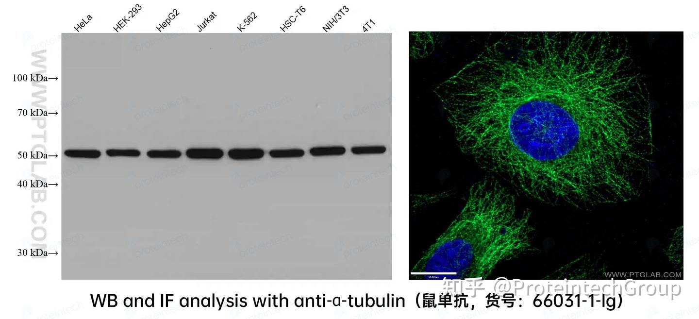 WB指南 | 18种常用WB内参大盘点！码住！ - 知乎