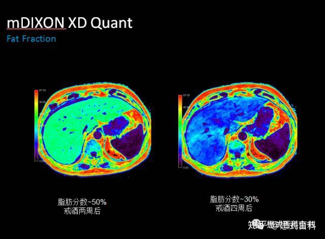 磁共振序列的命名及名称（不同厂家之间的序列名）（三） - 知乎