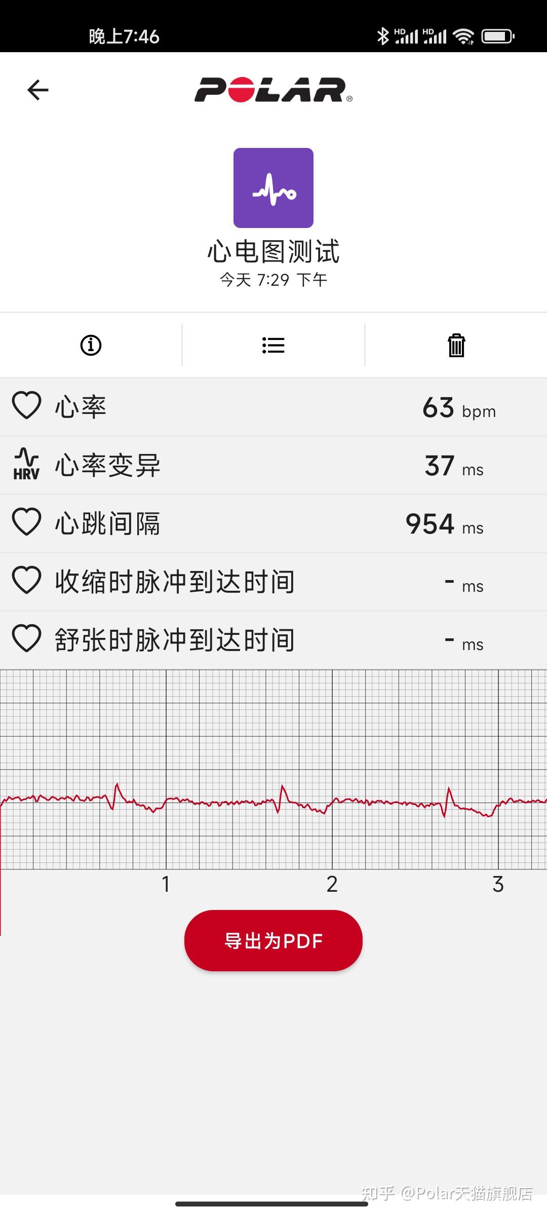 Polar Vantage V3 新功能之一：腕式ECG - 知乎