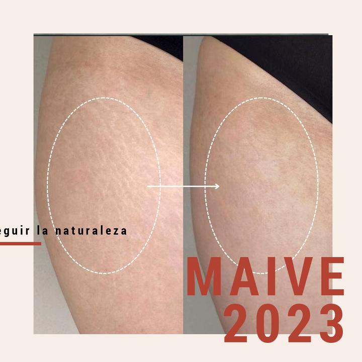 MAIVE skin肤色矫正是什么？ - 知乎